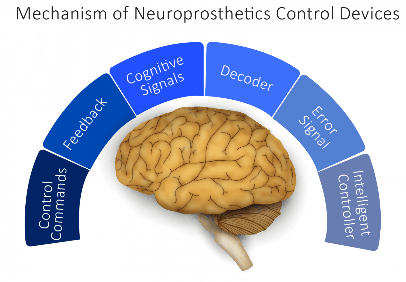 Neuroprosthetics Market to Surge due to Increasing Neurological Disorders