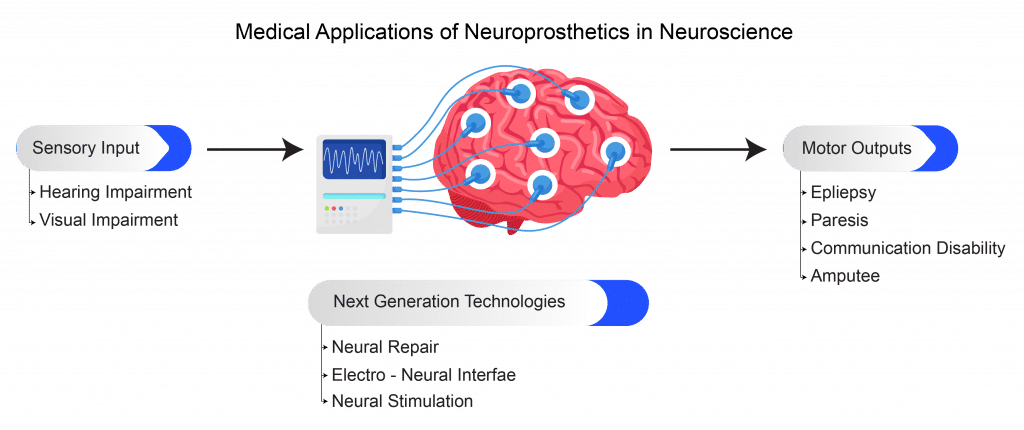 Neuroprosthetics Market to Surge due to Increasing Neurological Disorders