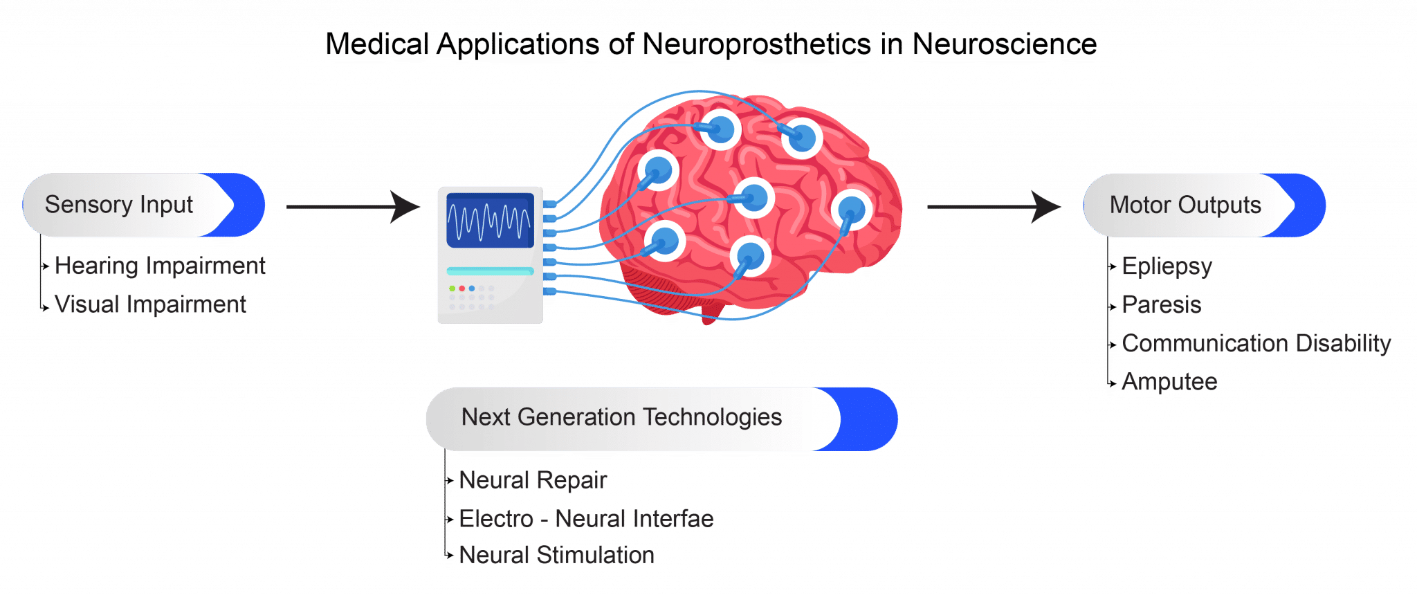 Neuroprosthetics Market to Surge due to Increasing Neurological Disorders