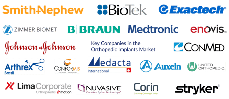 Orthopedic Implants Market | Growth Analysis and Key Companies