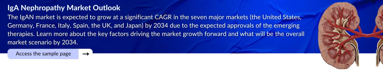 4 Promising IgA Nephropathy Drugs in Late-Stage Trials