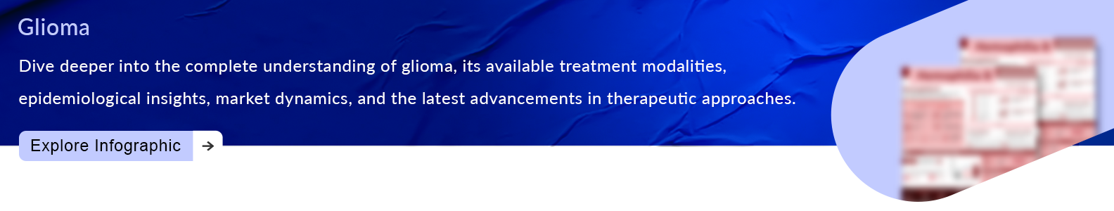 Glioma vs. Glioblastoma: Unraveling the Intricacies